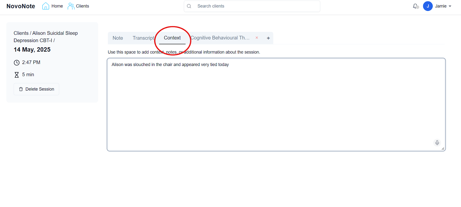 Add Context or Smart Edit : NovoNote Support