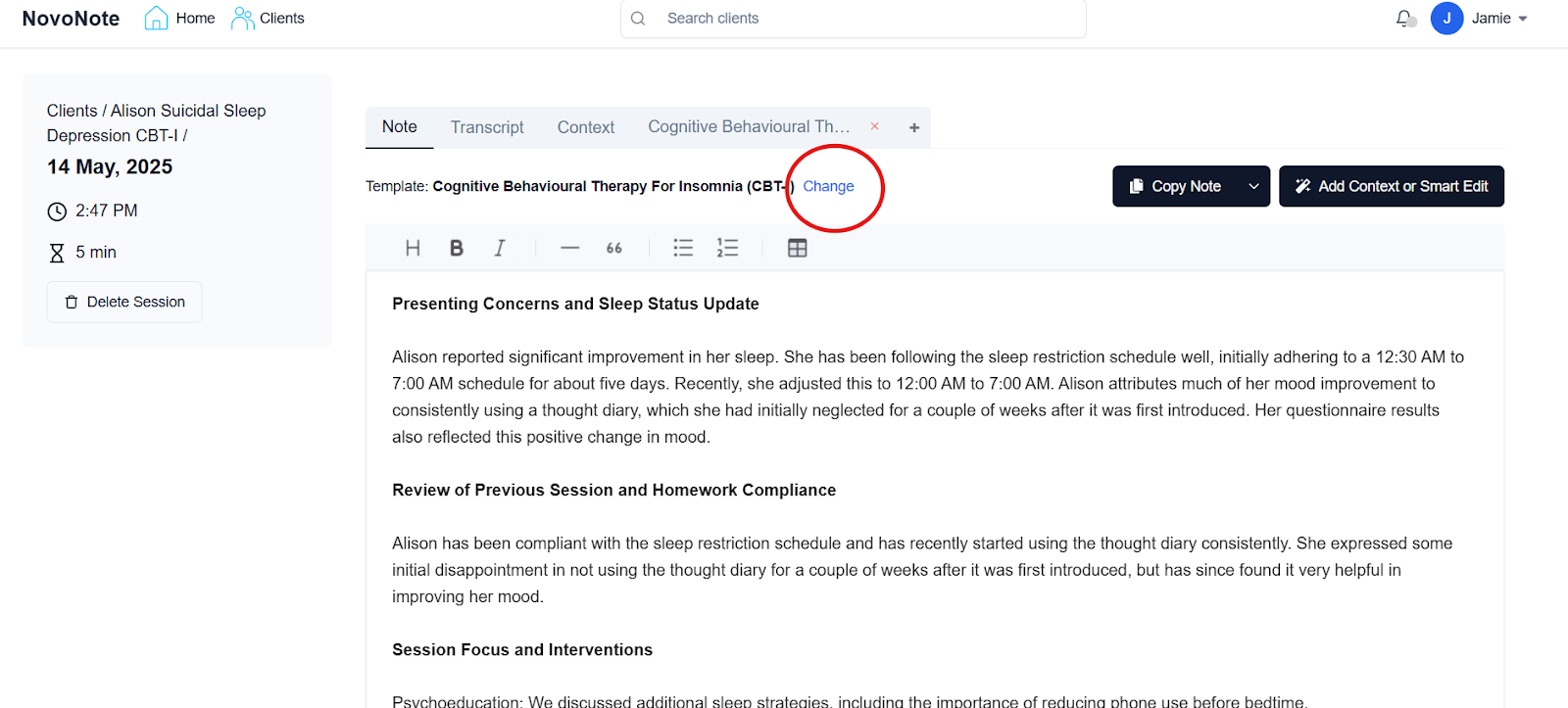 Incomplete Note or Note Cut Short : NovoNote Support