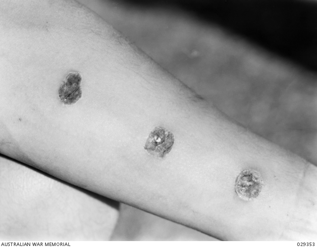 FORBES, NSW. 1943-02. LEFT FOREARM OF MAJOR F.S. (FREDDIE) GORRILL ...