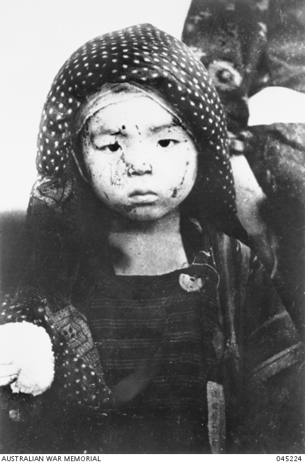 A small Japanese boy in Nagasaki holding a rice ball. The effects of ...
