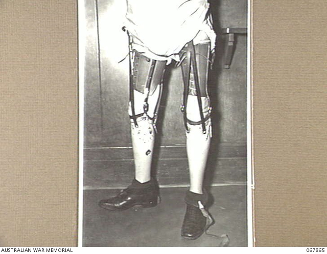 SYDNEY, NSW. 1944-07-28. POLYCENTRIC KNEE JOINTS (STANDING) WHICH ARE ...