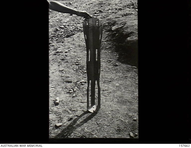 Majon'ni, Korea. 1953-07-24. Front view of an American type leg splint ...