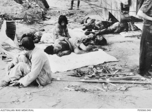 Dead and injured Japanese civilians in Nagasaki after the dropping of ...