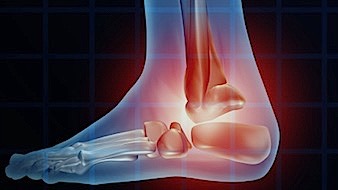 Clinical Edge - Imaging of Sports Injuries in the Foot & Ankle