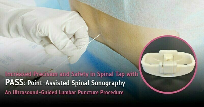 Increased Precision and Safety in Spinal Tap with PASS - An Ultrasound ...