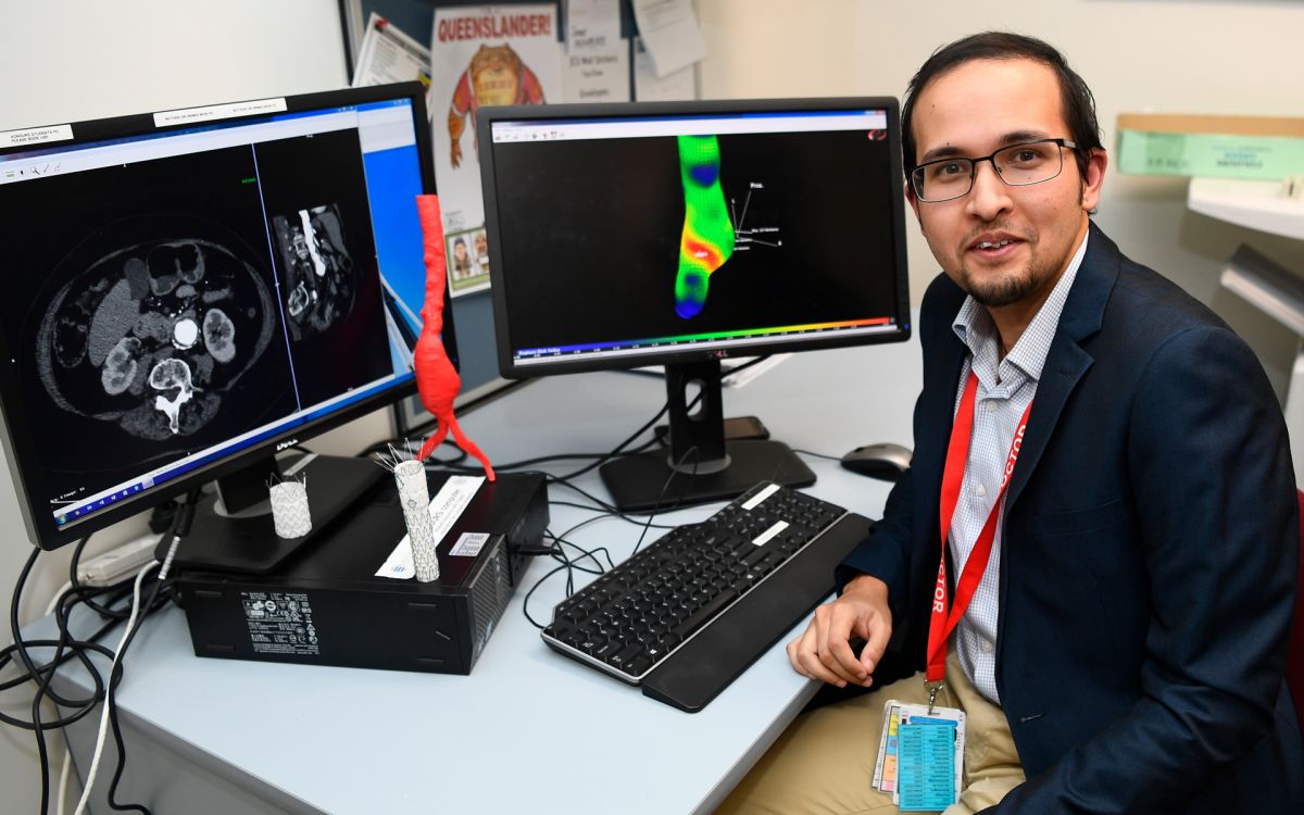 Junior doctor earns acclaim for vascular research | NQRTH