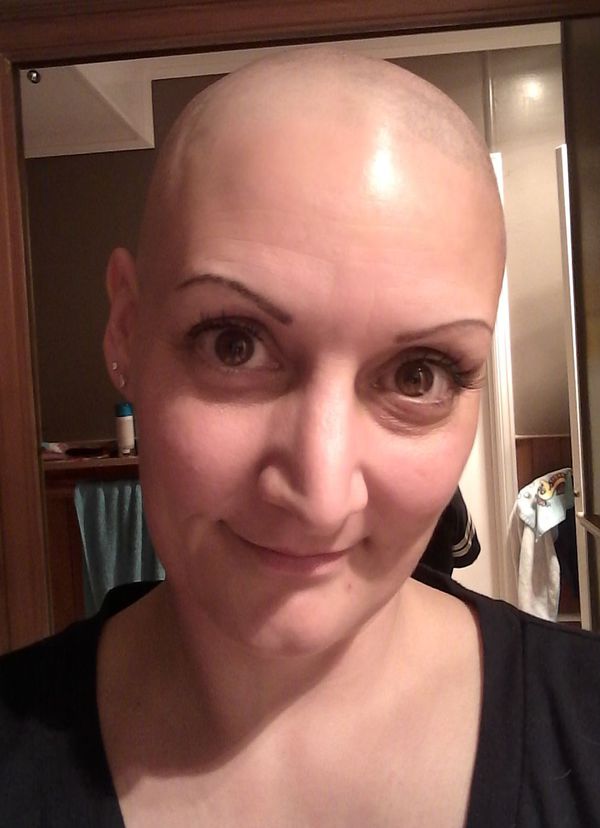 Hair Today, Gone tomorrow. Going bald (in a more creative way) for ...