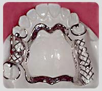 Cronulla Denture Care - partial dentures